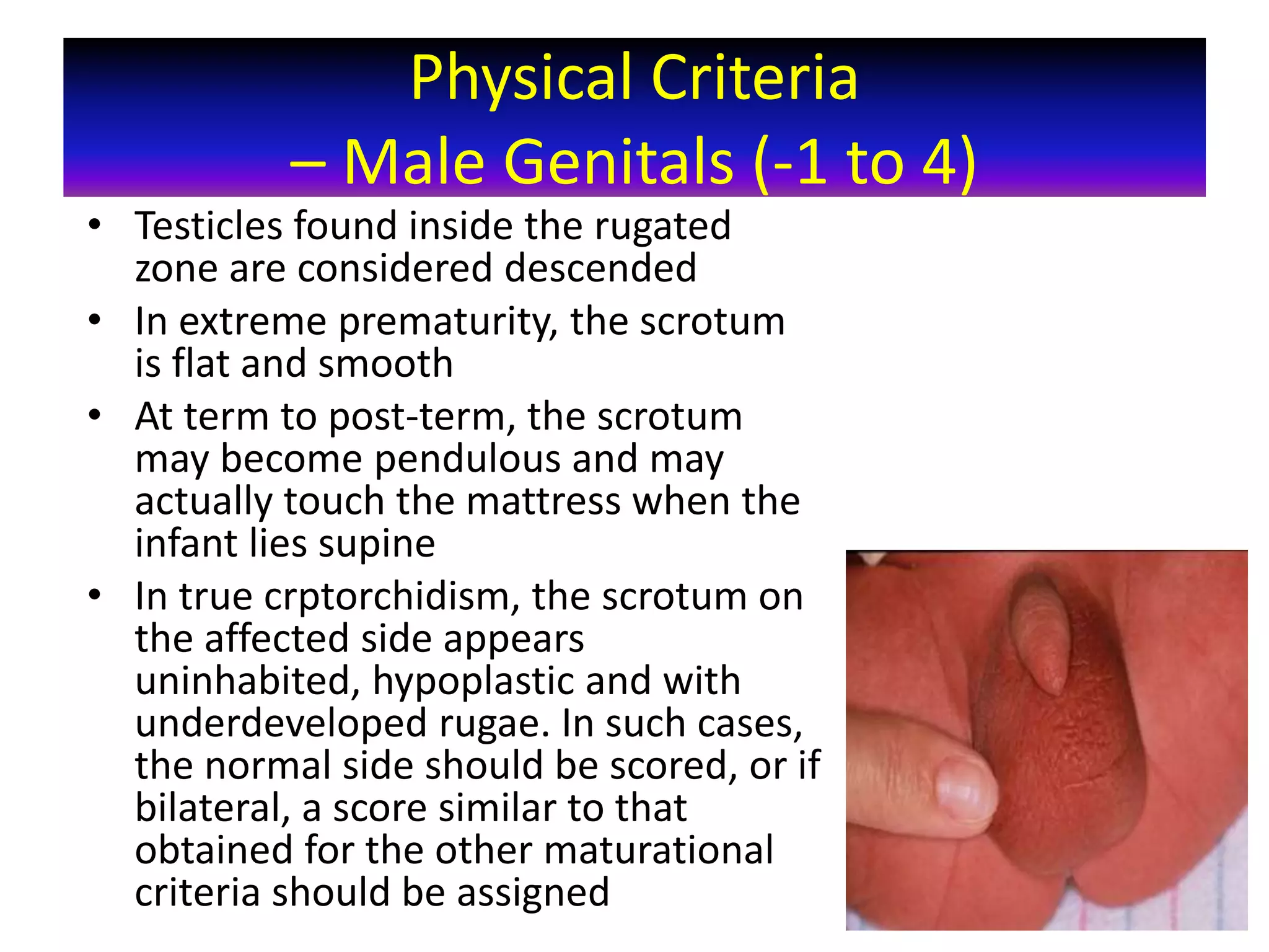 Assessment of Gestational age | PPTX