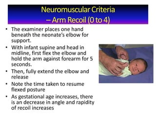 Assessment of Gestational age | PPTX