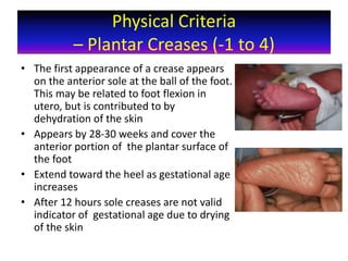 Assessment of Gestational age | PPTX