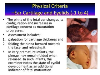 Assessment of Gestational age | PPTX