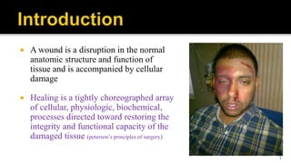 Wound healing | PPTX