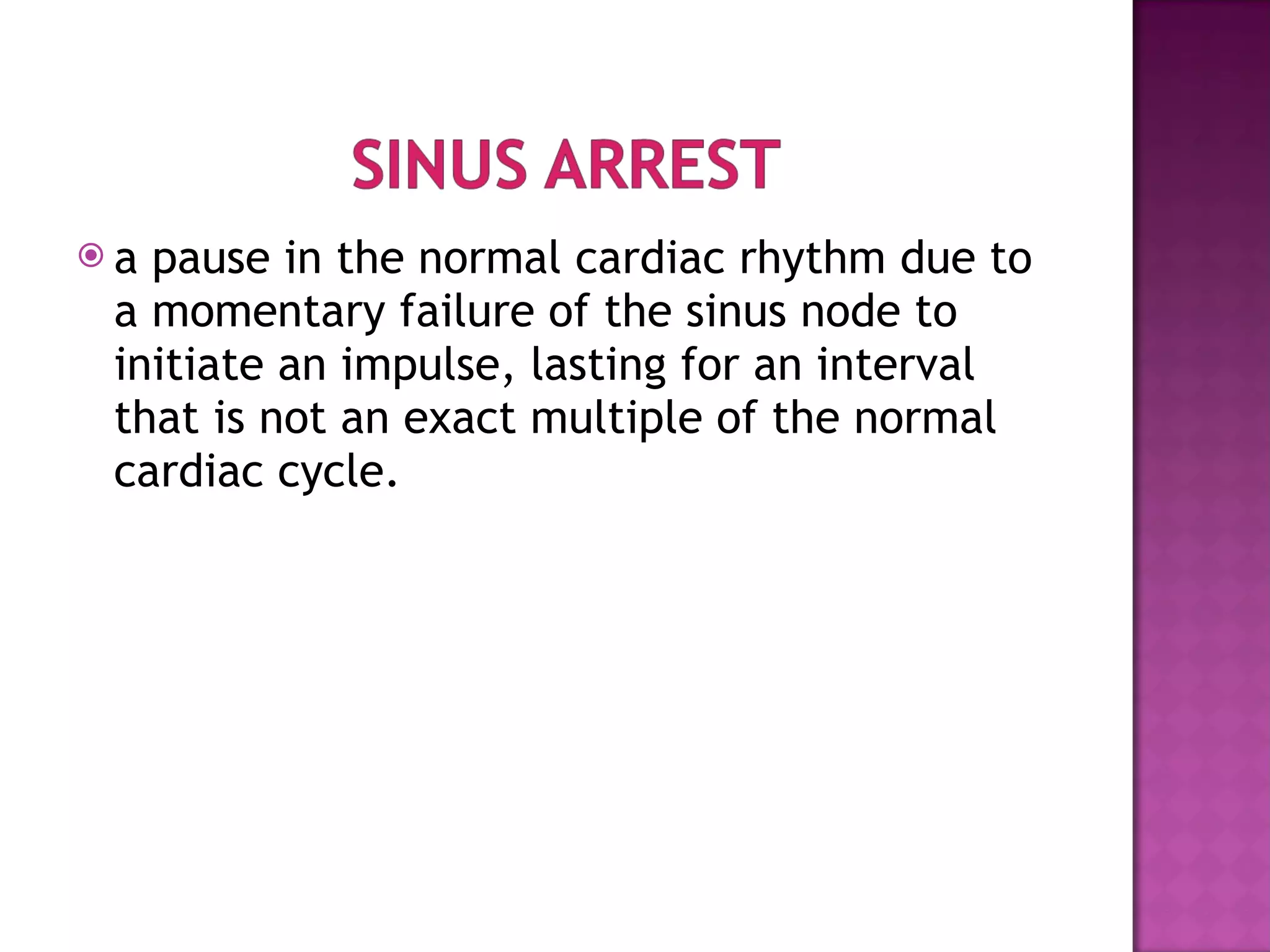 ECG: Multifocal Atrial Tachycardia | PPT