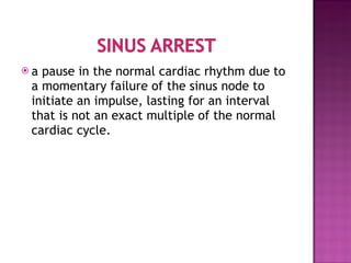 ECG: Multifocal Atrial Tachycardia | PPT