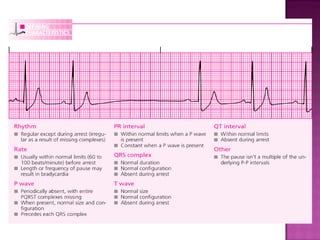 ECG: Multifocal Atrial Tachycardia | PPT