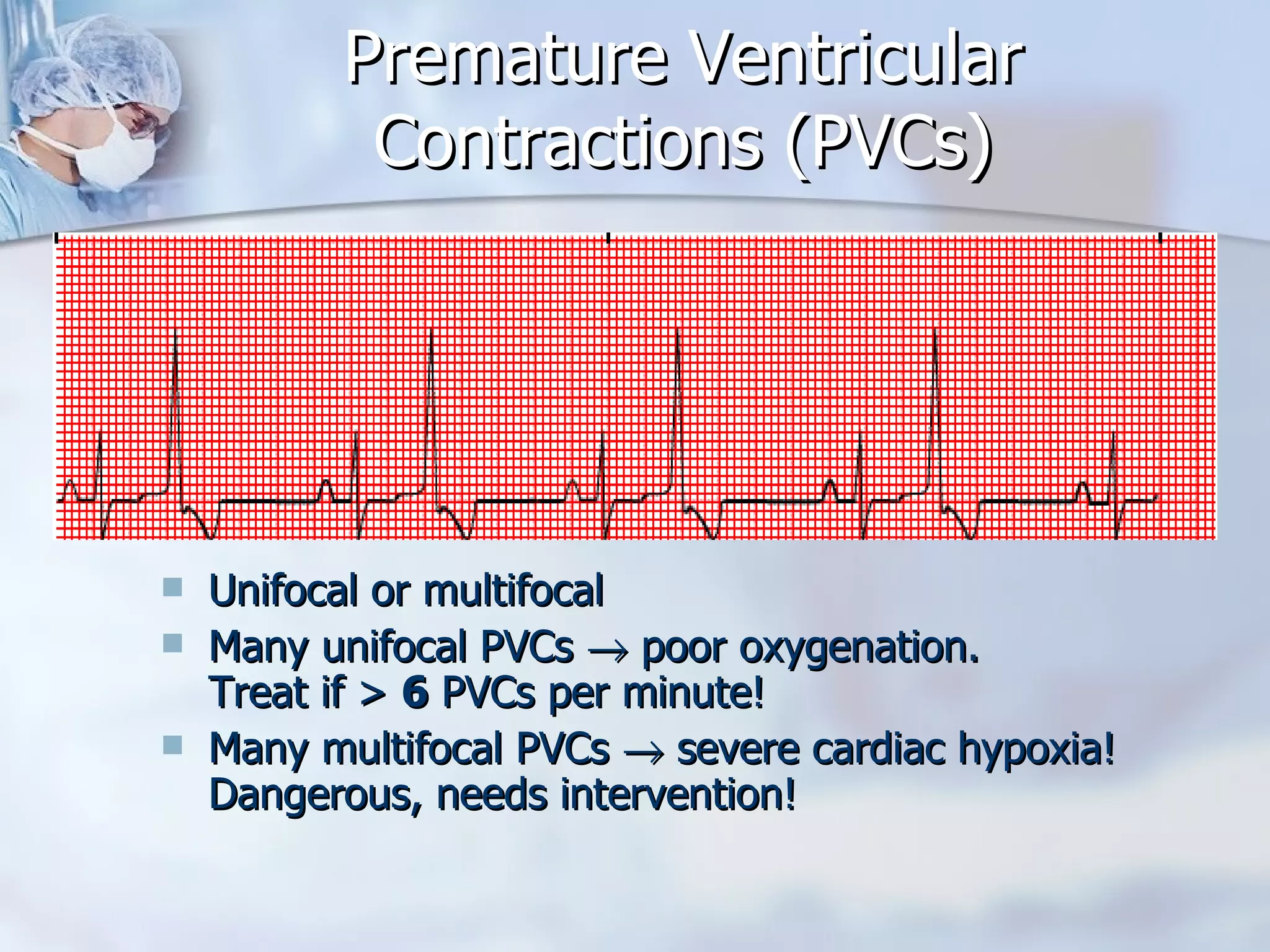 Management of Cardiac Surgery Patients and role of PA's | PPT