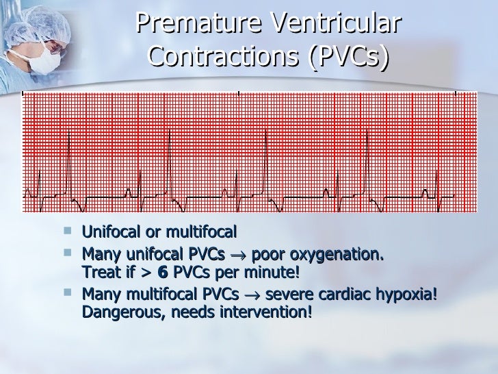 Management of Cardiac Surgery Patients and role of PA's