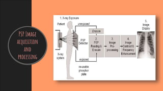 Cassette Digital radiography (COMPUTED RADIOGRAPHY) | PPTX