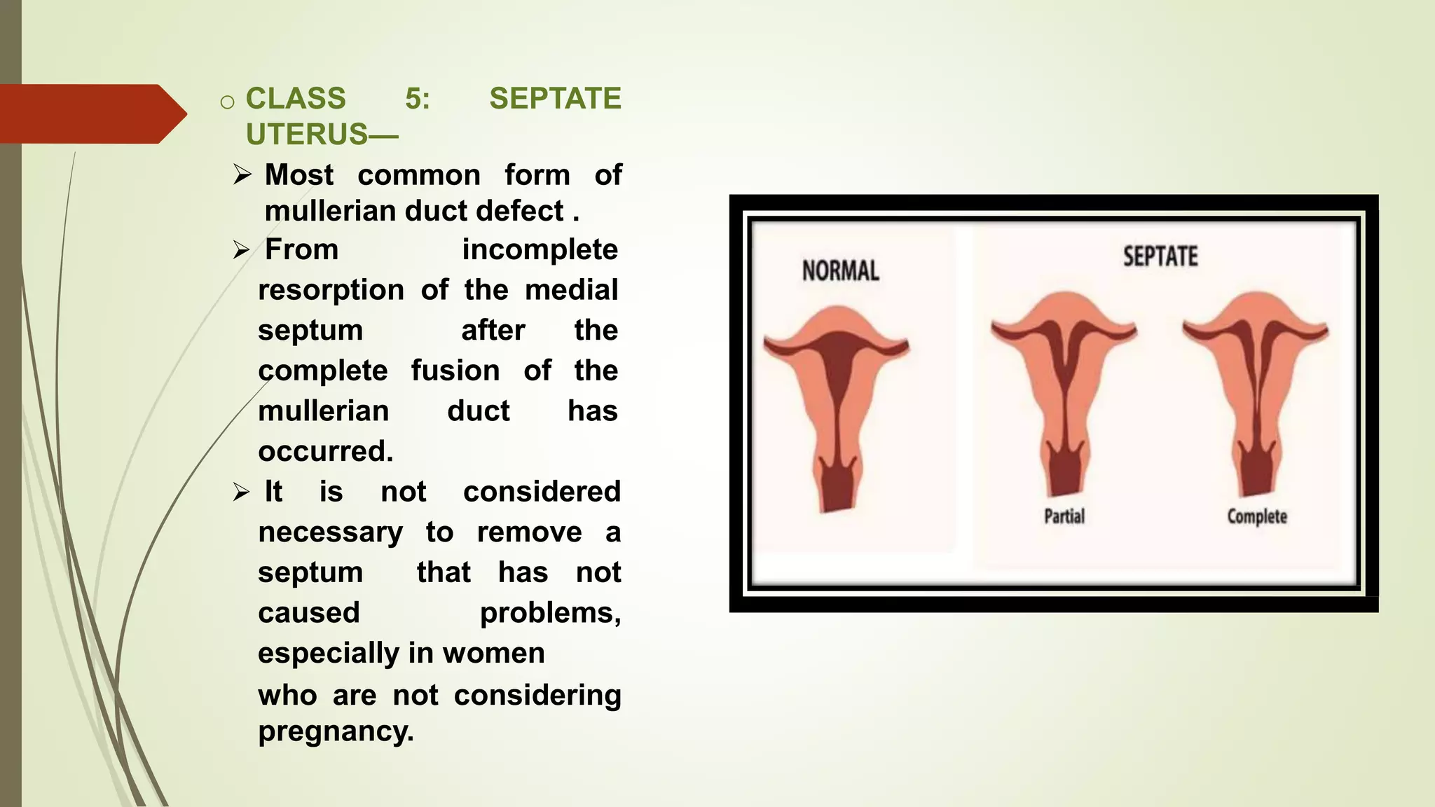uterine abnormality | PPTX