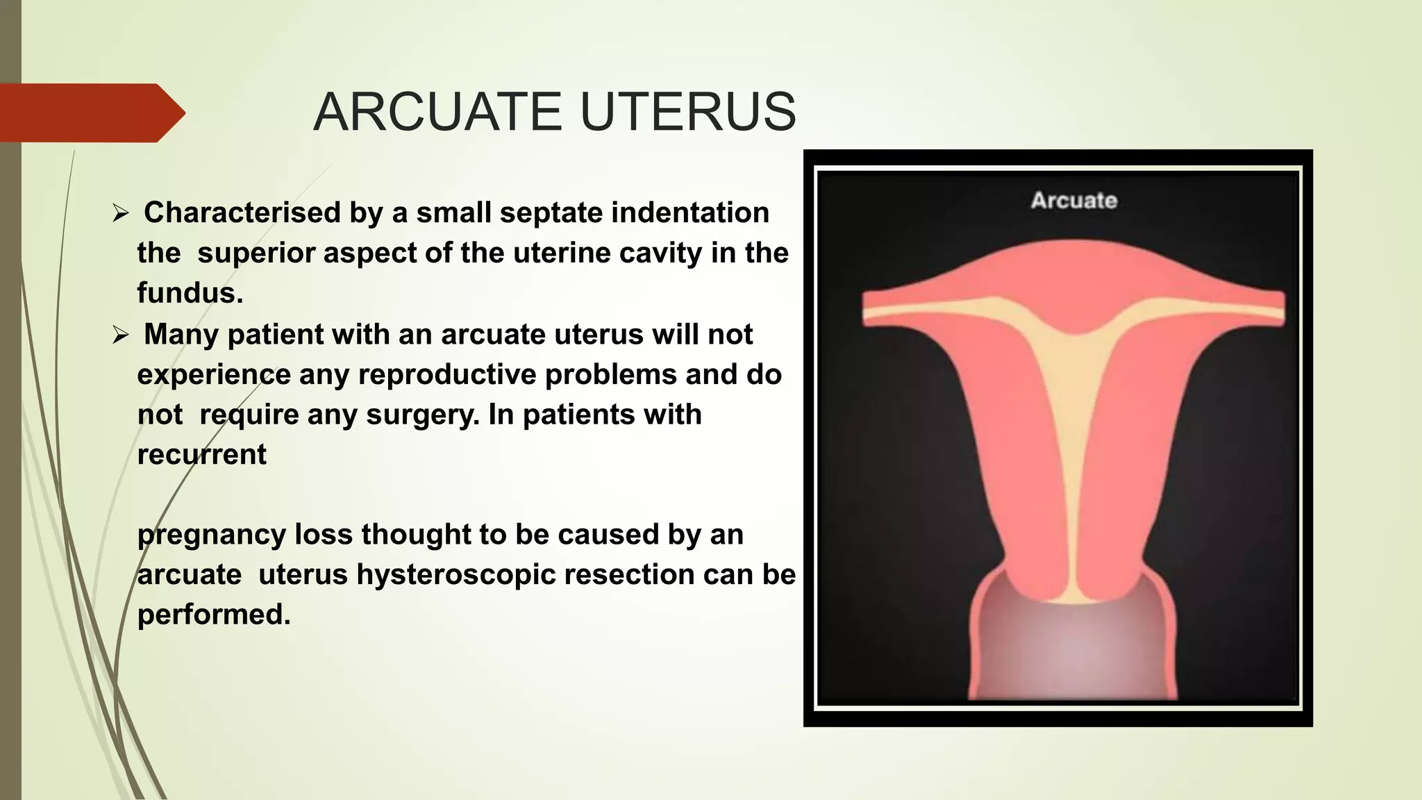uterine abnormality | PPTX