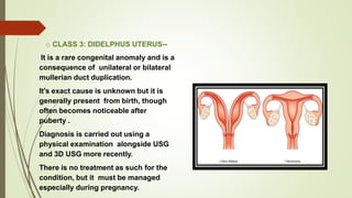 uterine abnormality | PPTX