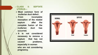 How Rare Is Septate Uterus