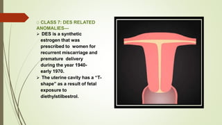 uterine abnormality | PPTX