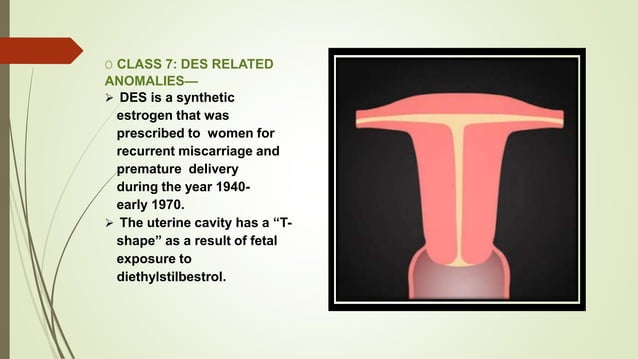 uterine abnormality | PPTX | Pregnancy | Reproductive Health
