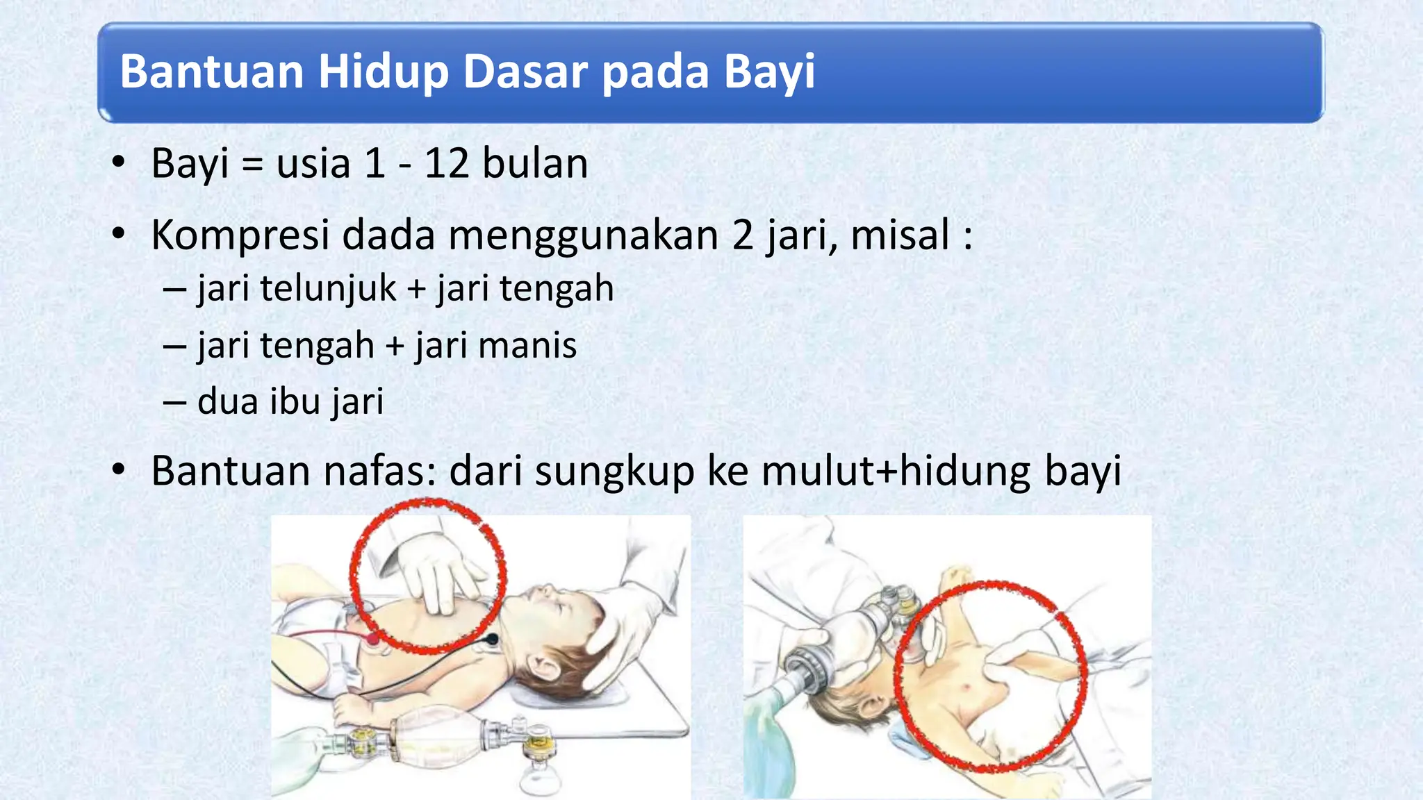 BHD DAN BHL (bantuan Hidup Dasar dan Bantuan Hidup Lanjut .pptx