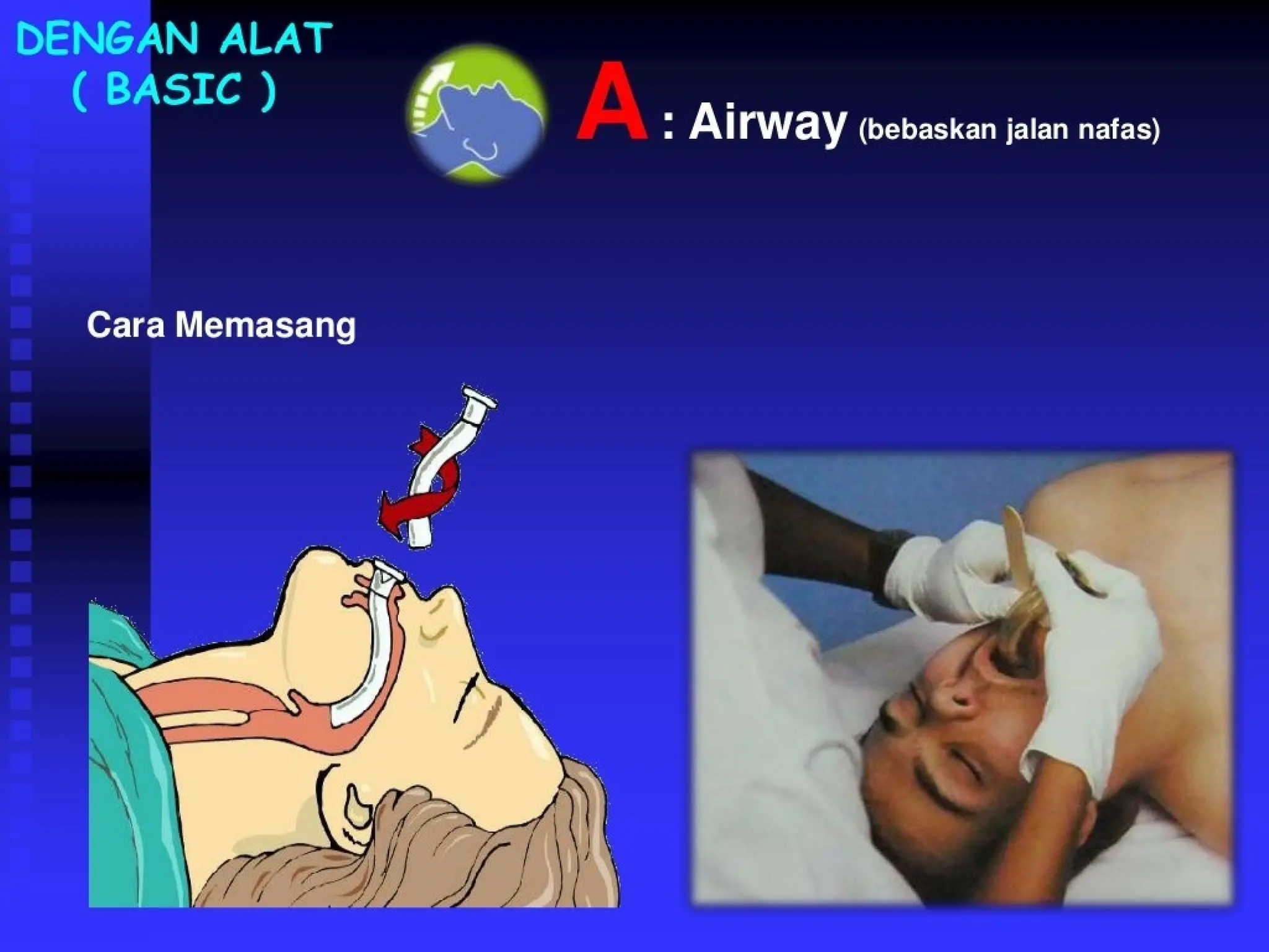 BANTUAN HIDUP DASAR PADA DEWASA, ANAK DAN BAYI.pptx