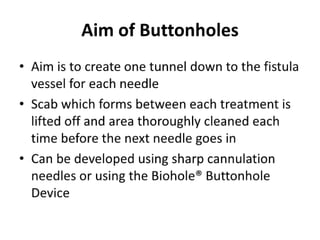 Bioholes® for buttonholing in Dialysis | PPT