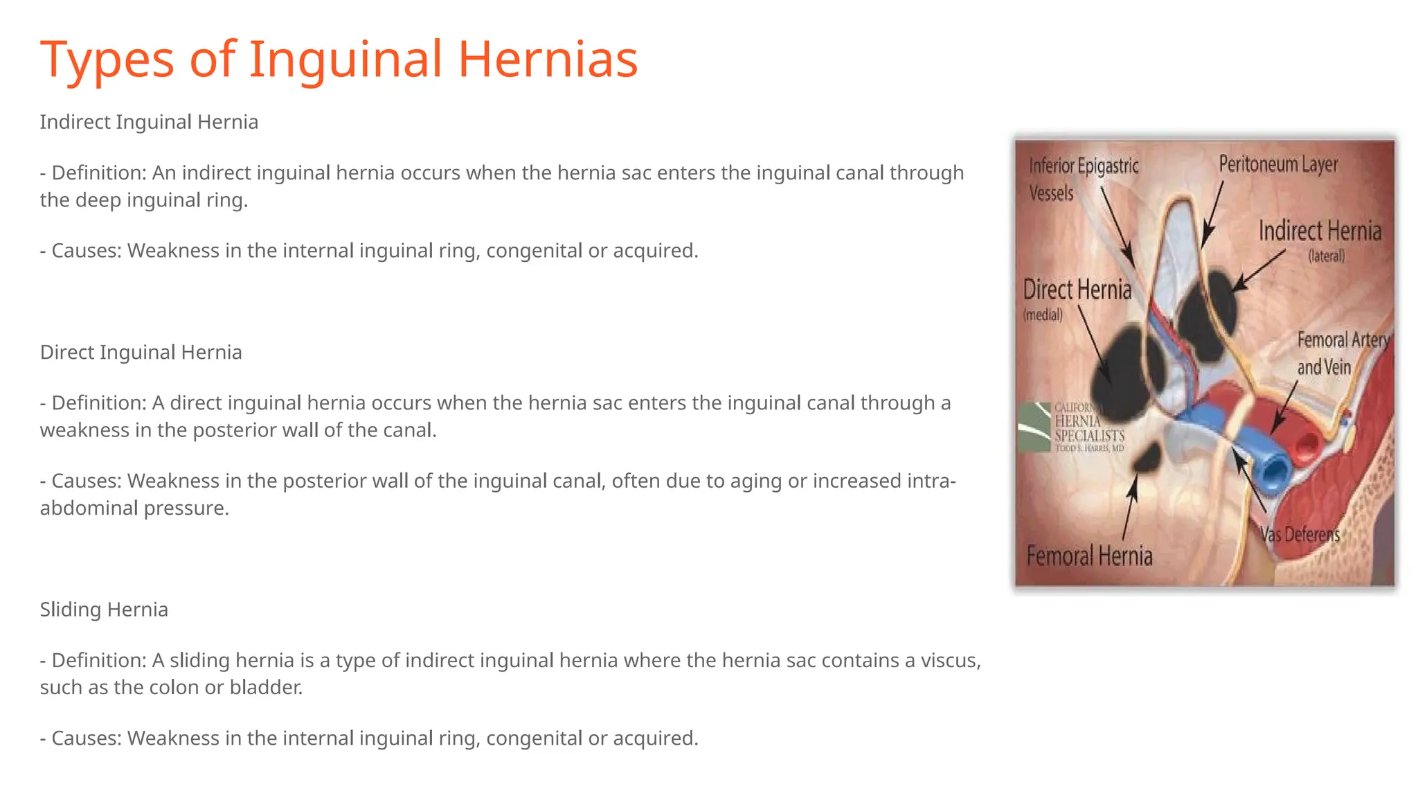 Inguinal hernia detailed about hernia all | PPTX