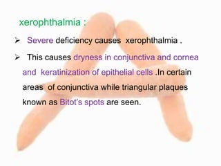 Phrynoderma Vitamin A Deficiency