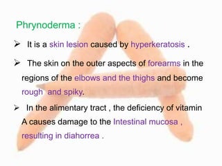 Phrynoderma Treatment