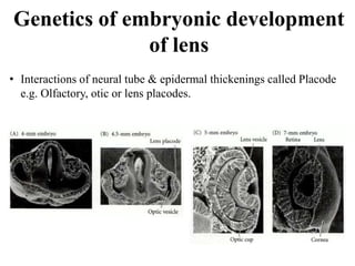 Bhupi clinical genetics cataract | PPTX