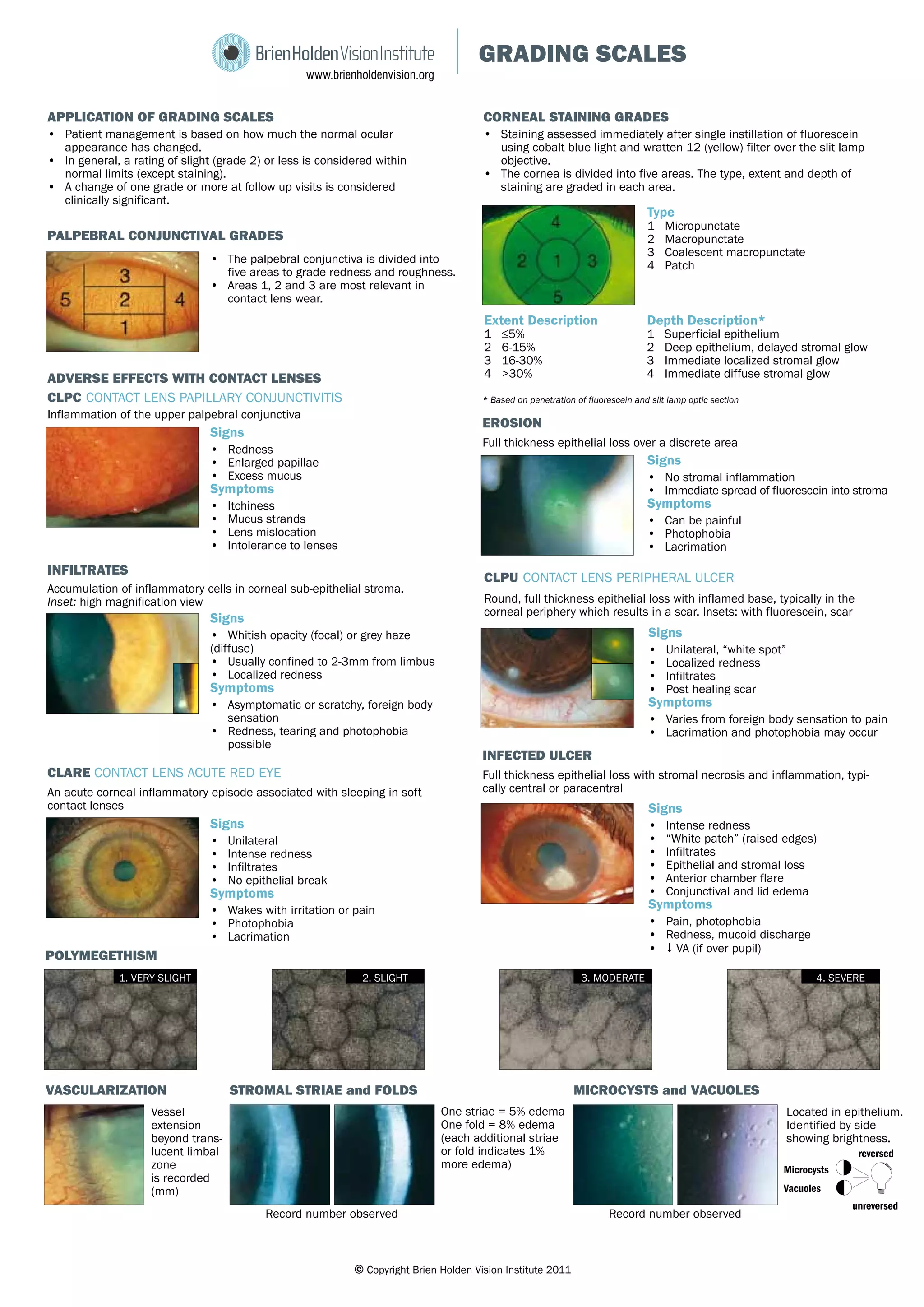 Echelle de gradation BHVI - Contactologie | PDF
