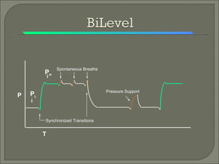 Bi level ventilation support | PPT