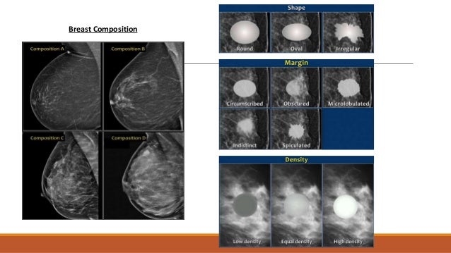 BI-RADS (MAMMOGRAPHY)