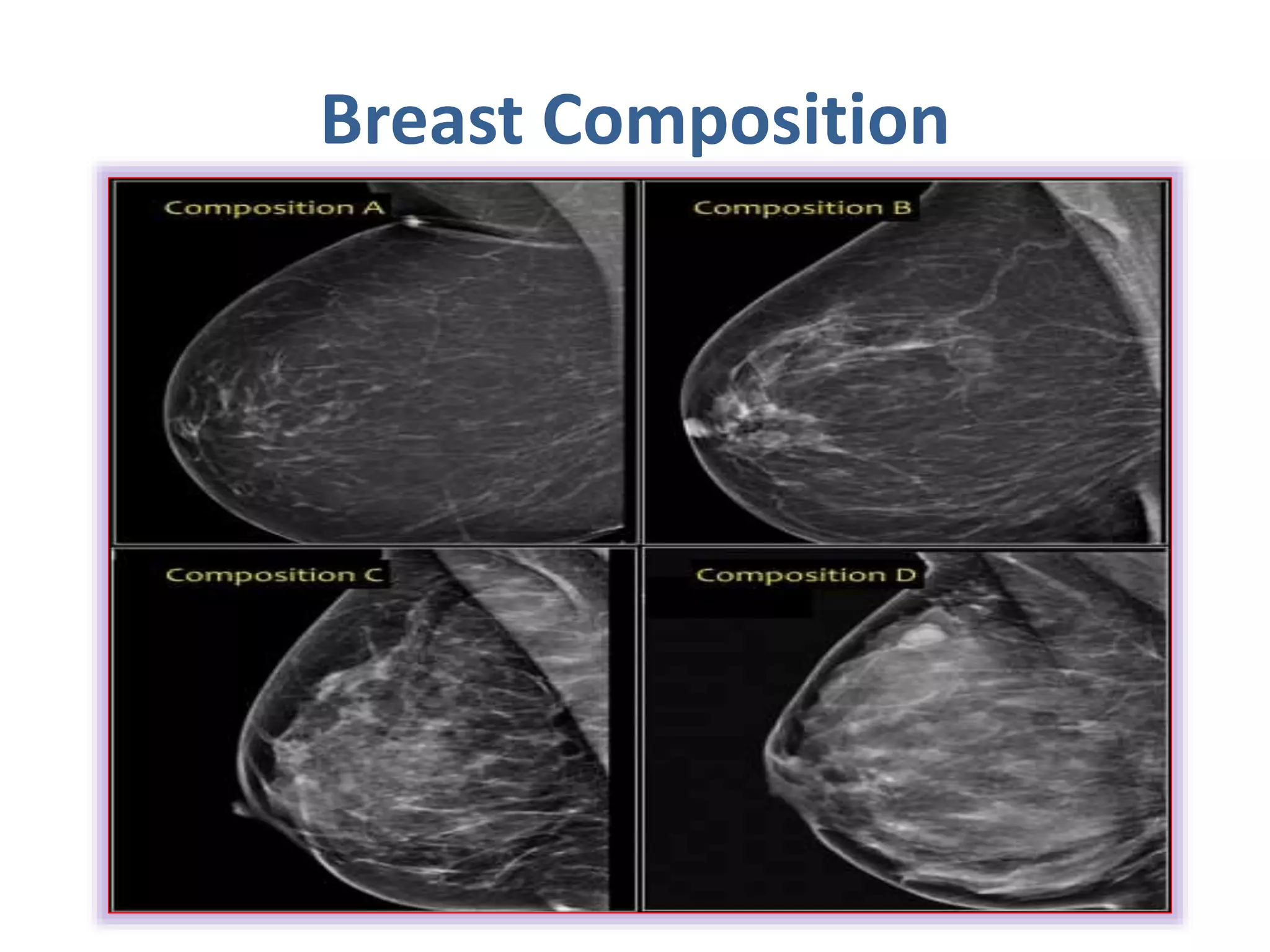 Bi Rads Breast | PPTX