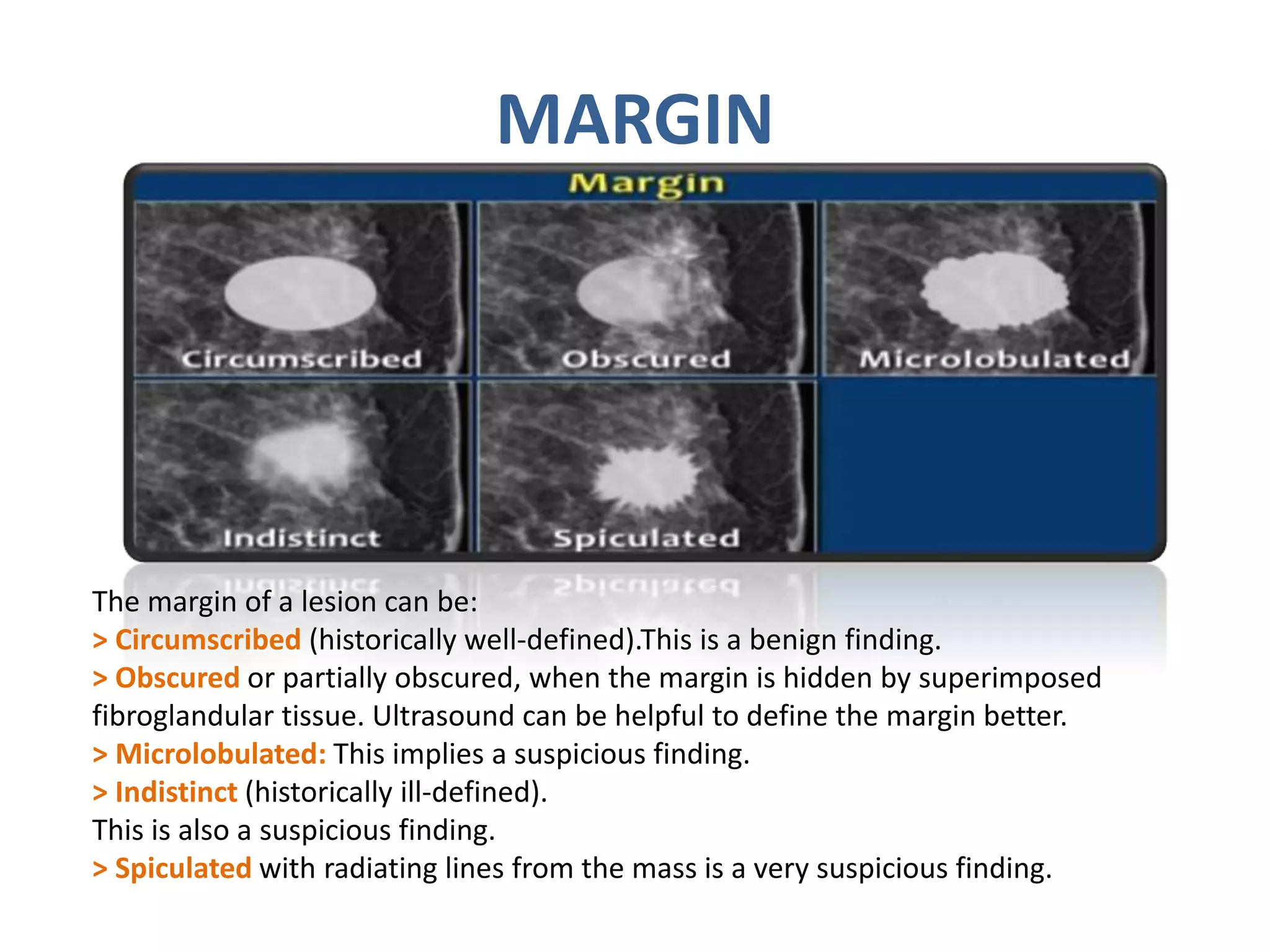 Bi Rads Breast | PPTX