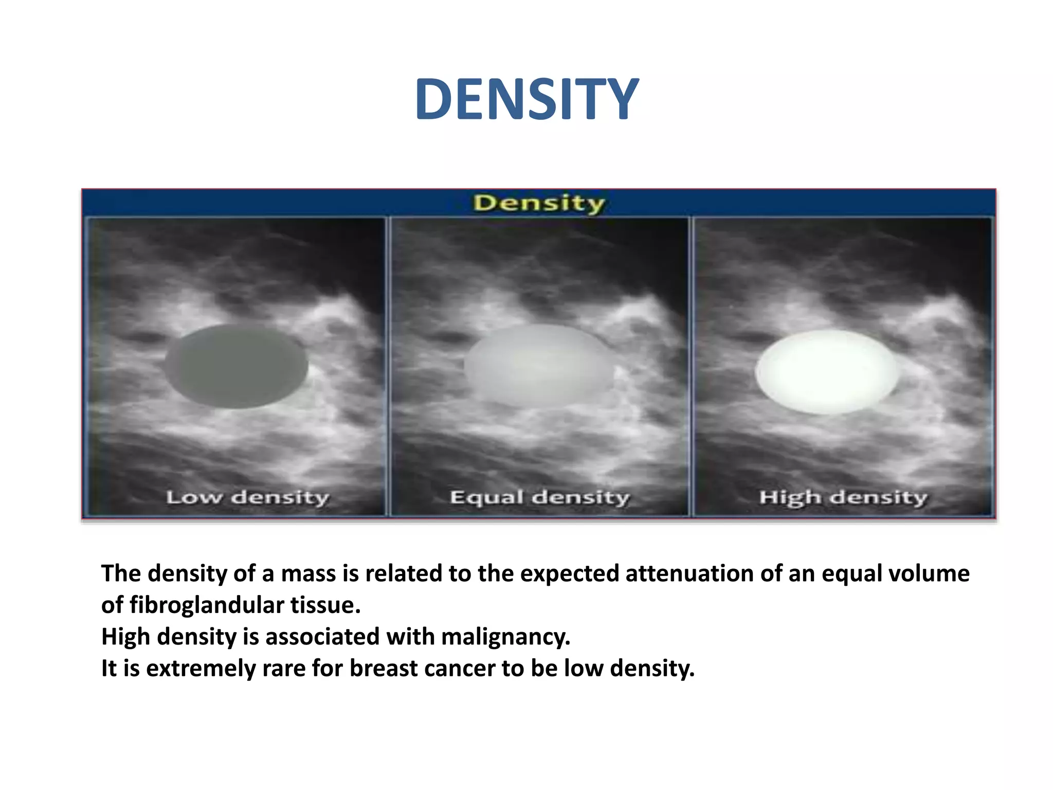Bi Rads Breast | PPTX