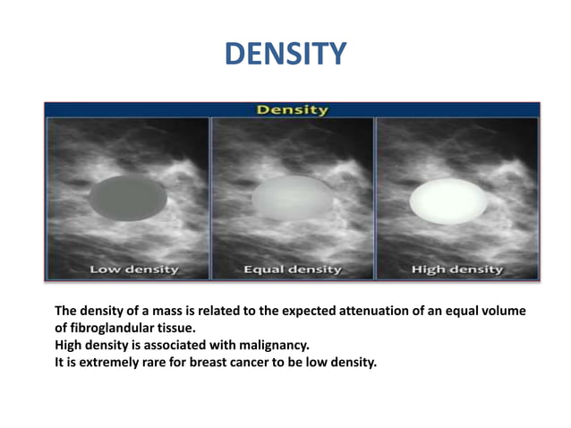 Bi Rads Breast | PPTX