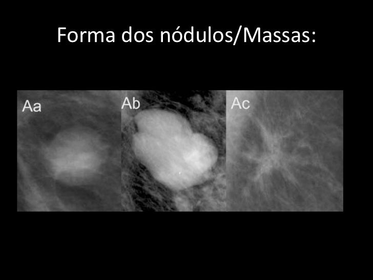 Bi rads - mamografia