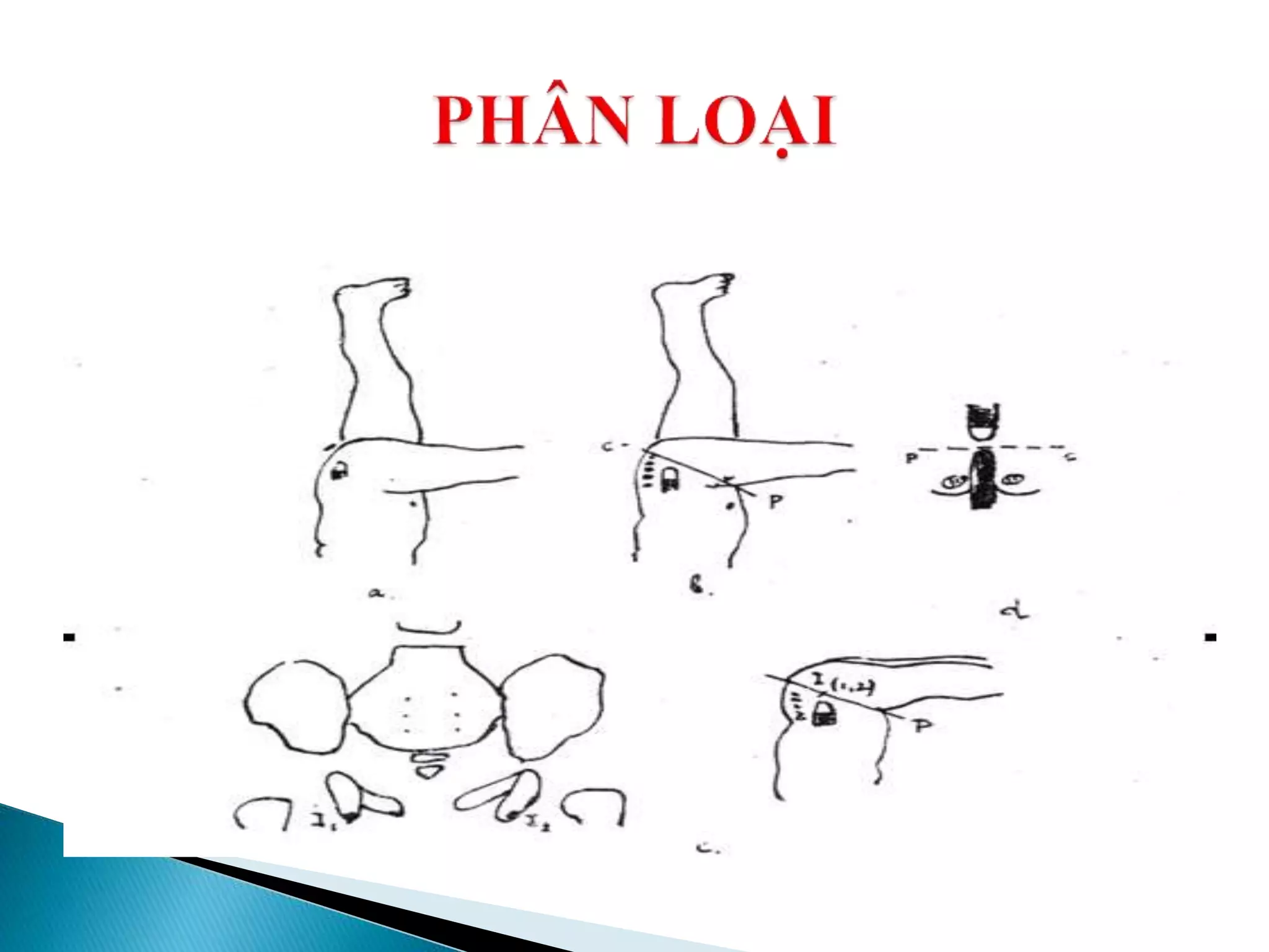 Bài 17. Dị dạng HMTT (Nhi).pptx