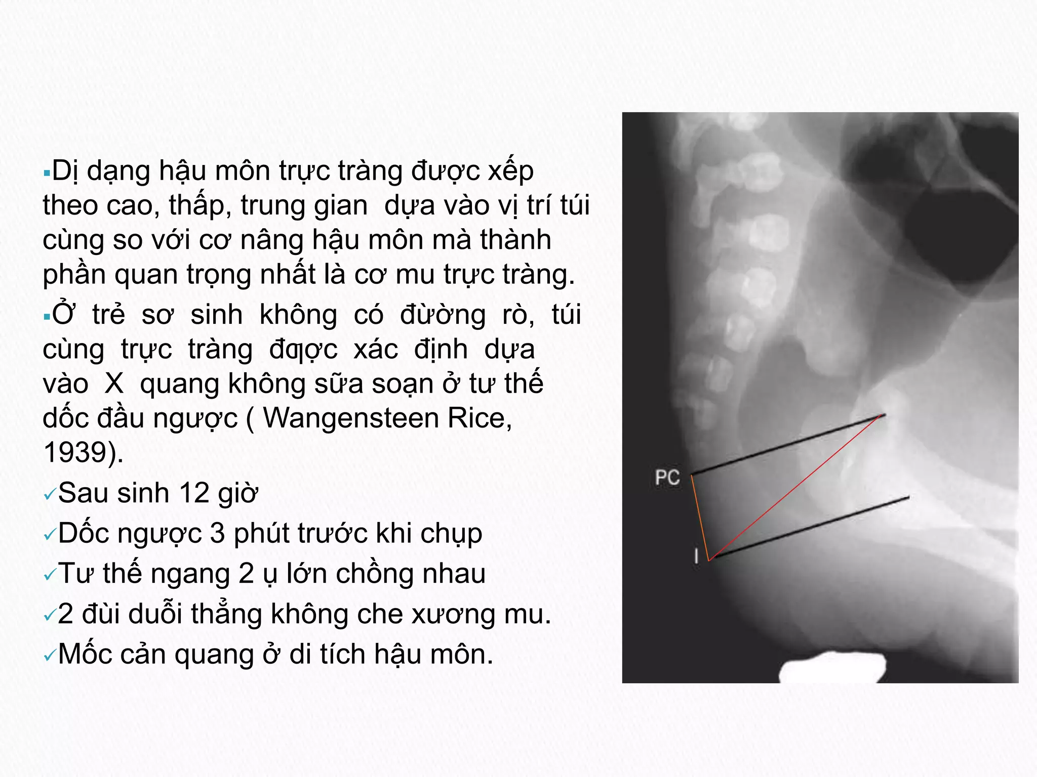 Bài 17. Dị dạng HMTT (Nhi).pptx