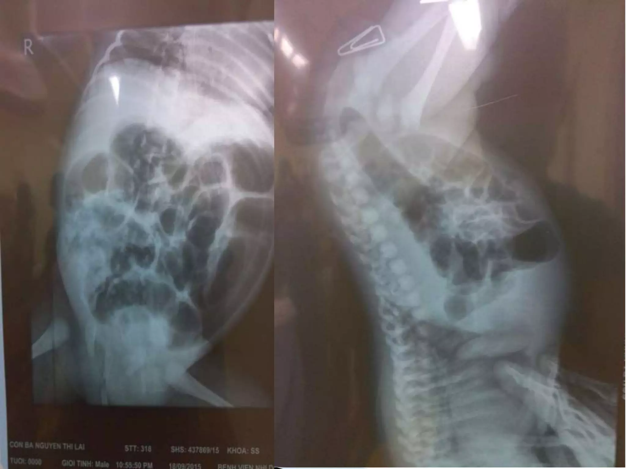 Bài 17. Dị dạng HMTT (Nhi).pptx