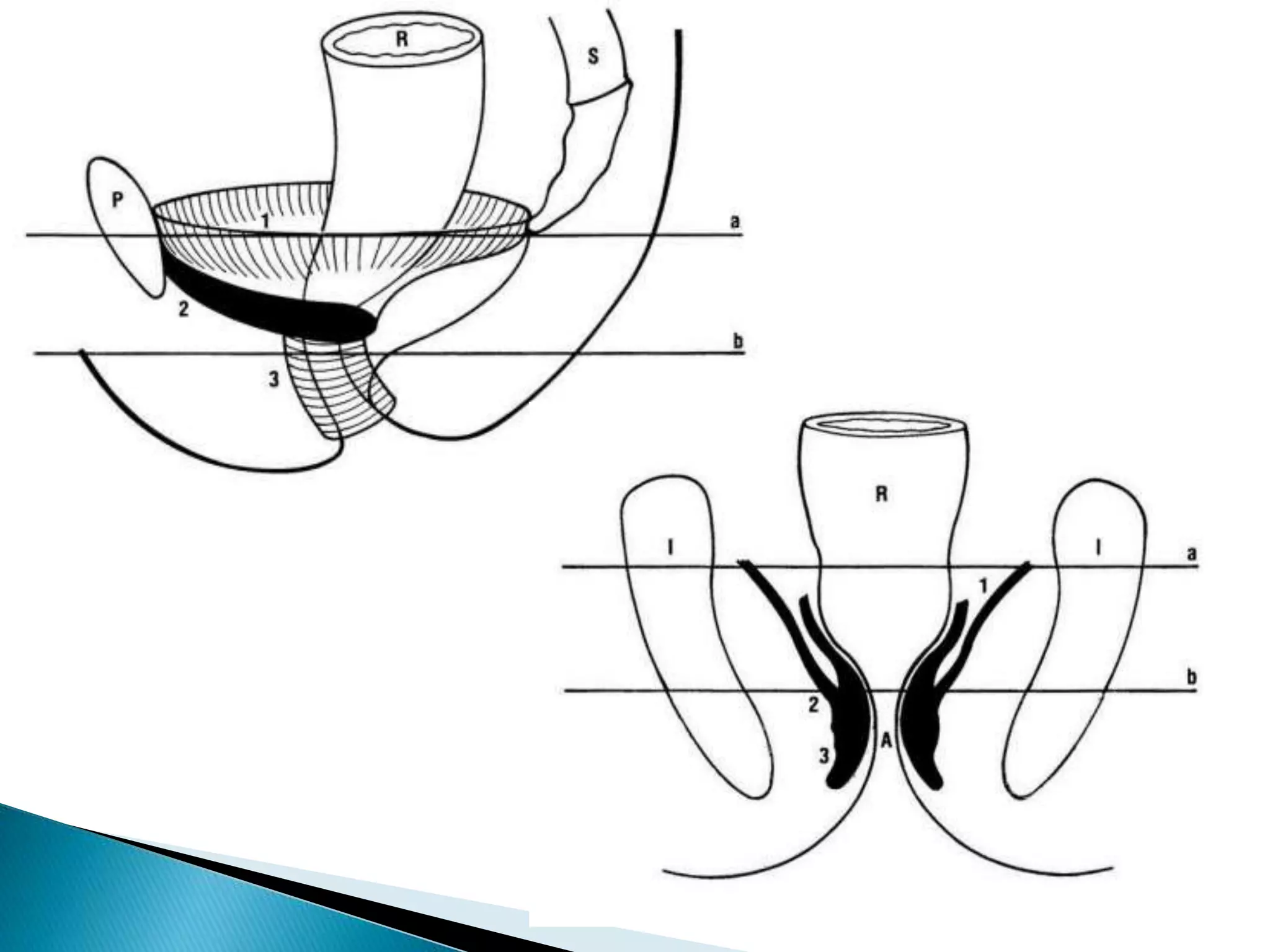 Bài 17. Dị dạng HMTT (Nhi).pptx