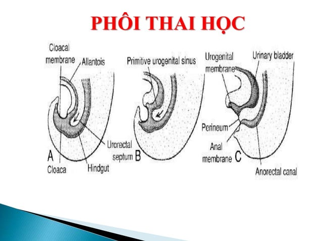 Bài 17. Dị dạng HMTT (Nhi).pptx