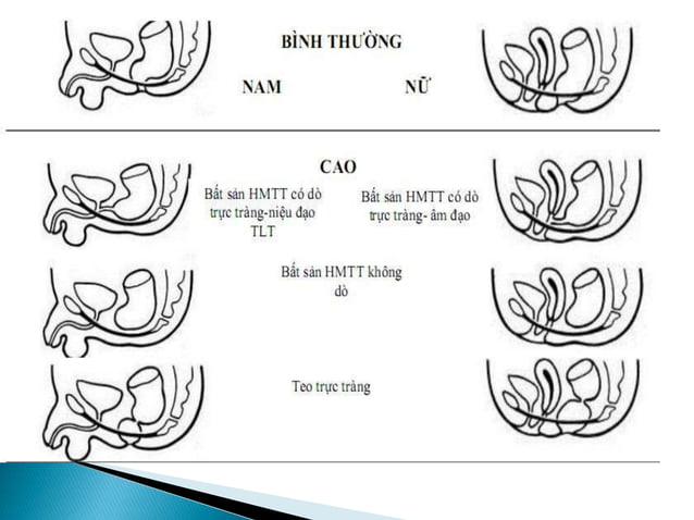 Bài 17. Dị dạng HMTT (Nhi).pptx