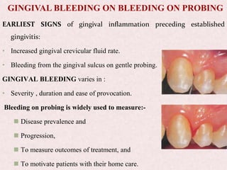 Gingival inflammation and features | PPTX