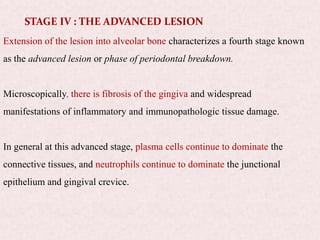 Stages Of Gingivitis