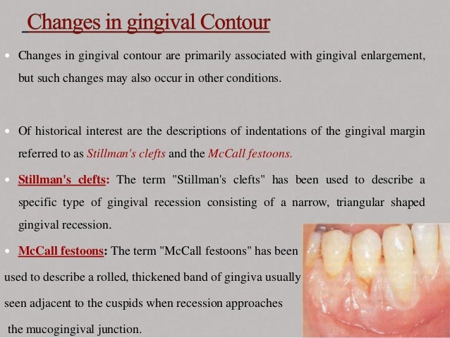 Gingival inflammation and features