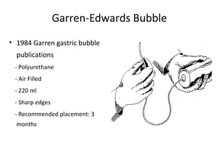 Intragastric Balloons for Treatment of Obesity | PPT
