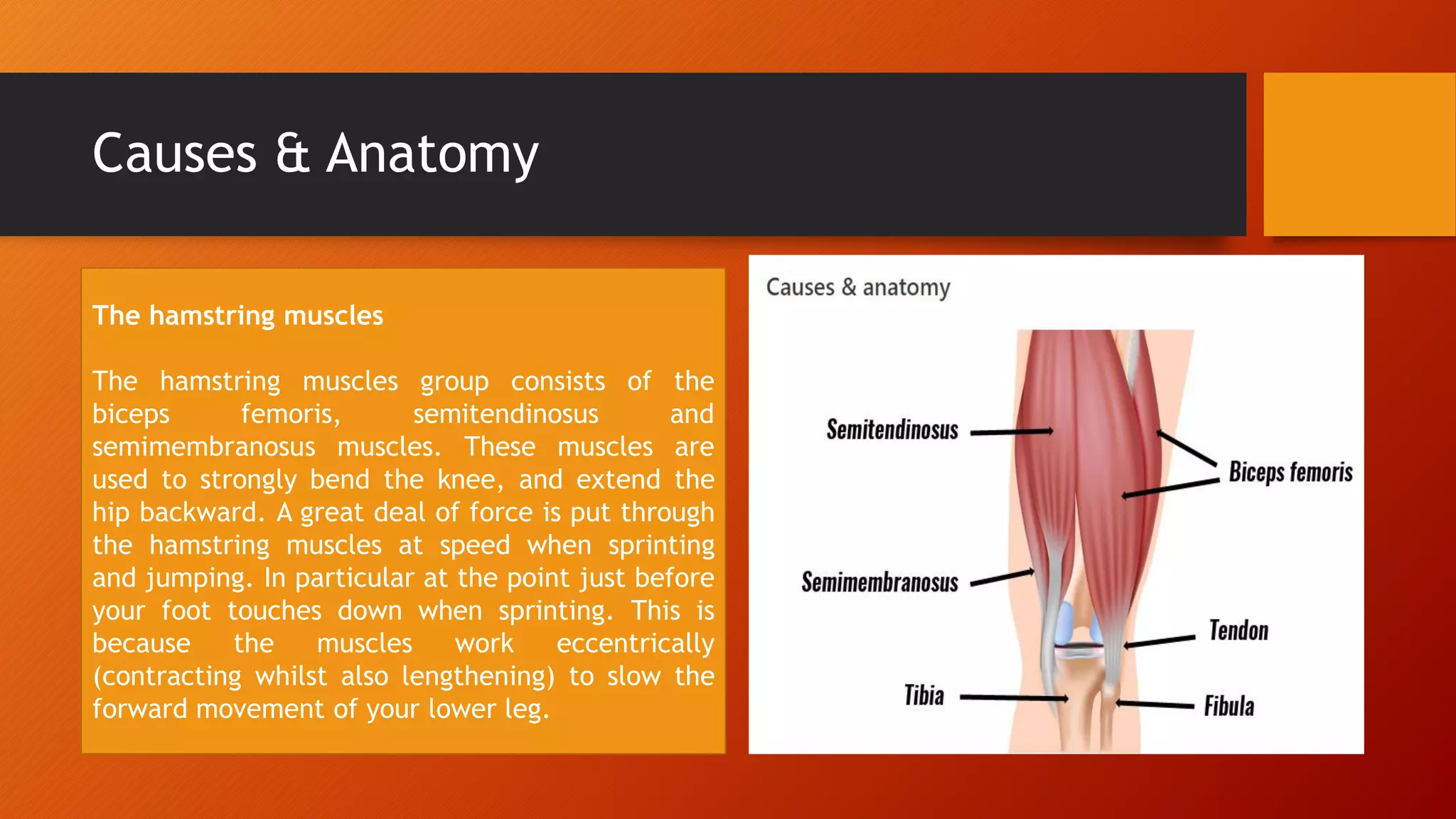 Bicep Femoris Tendinitis | PDF