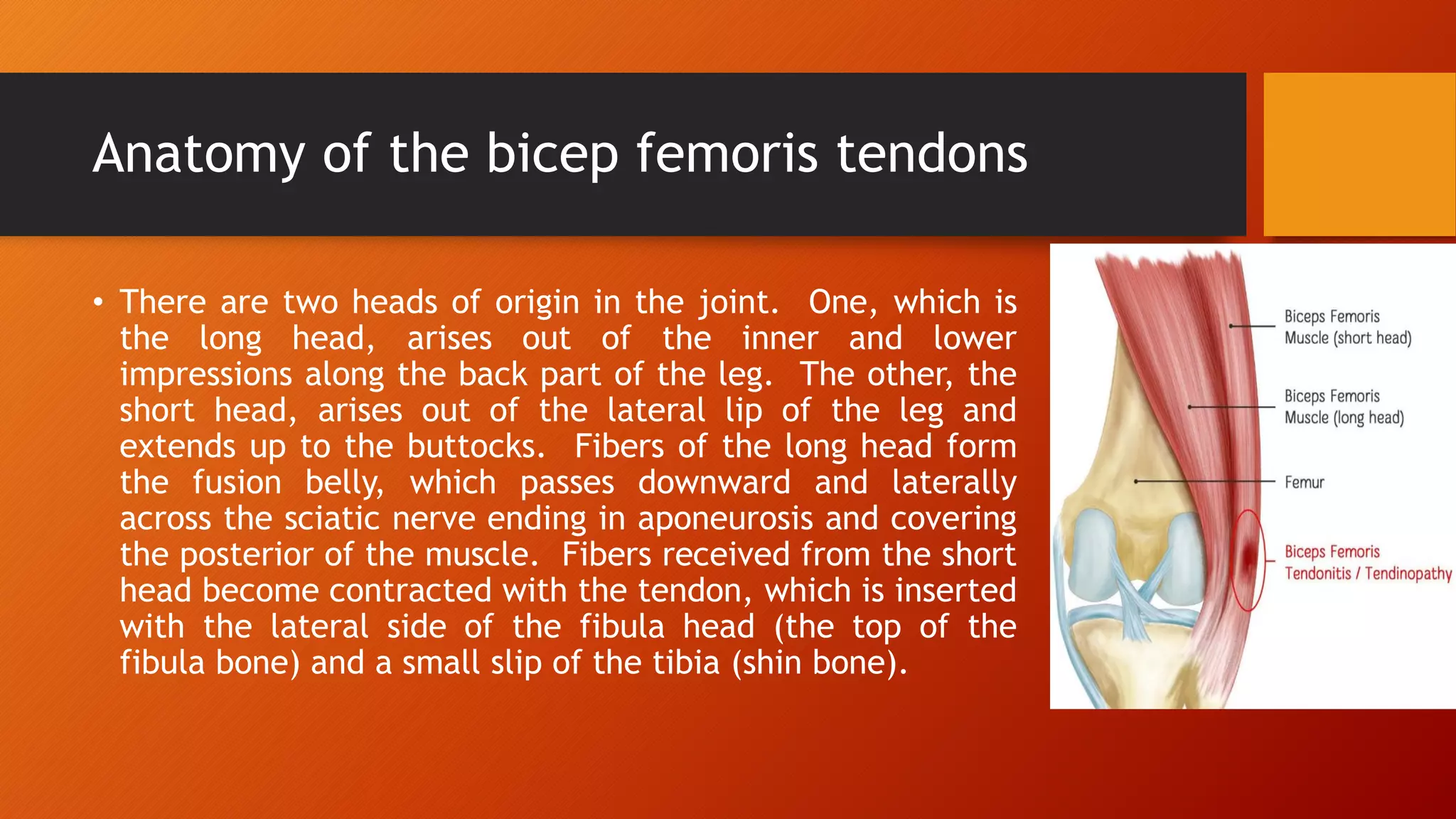 Bicep Femoris Tendinitis | PDF