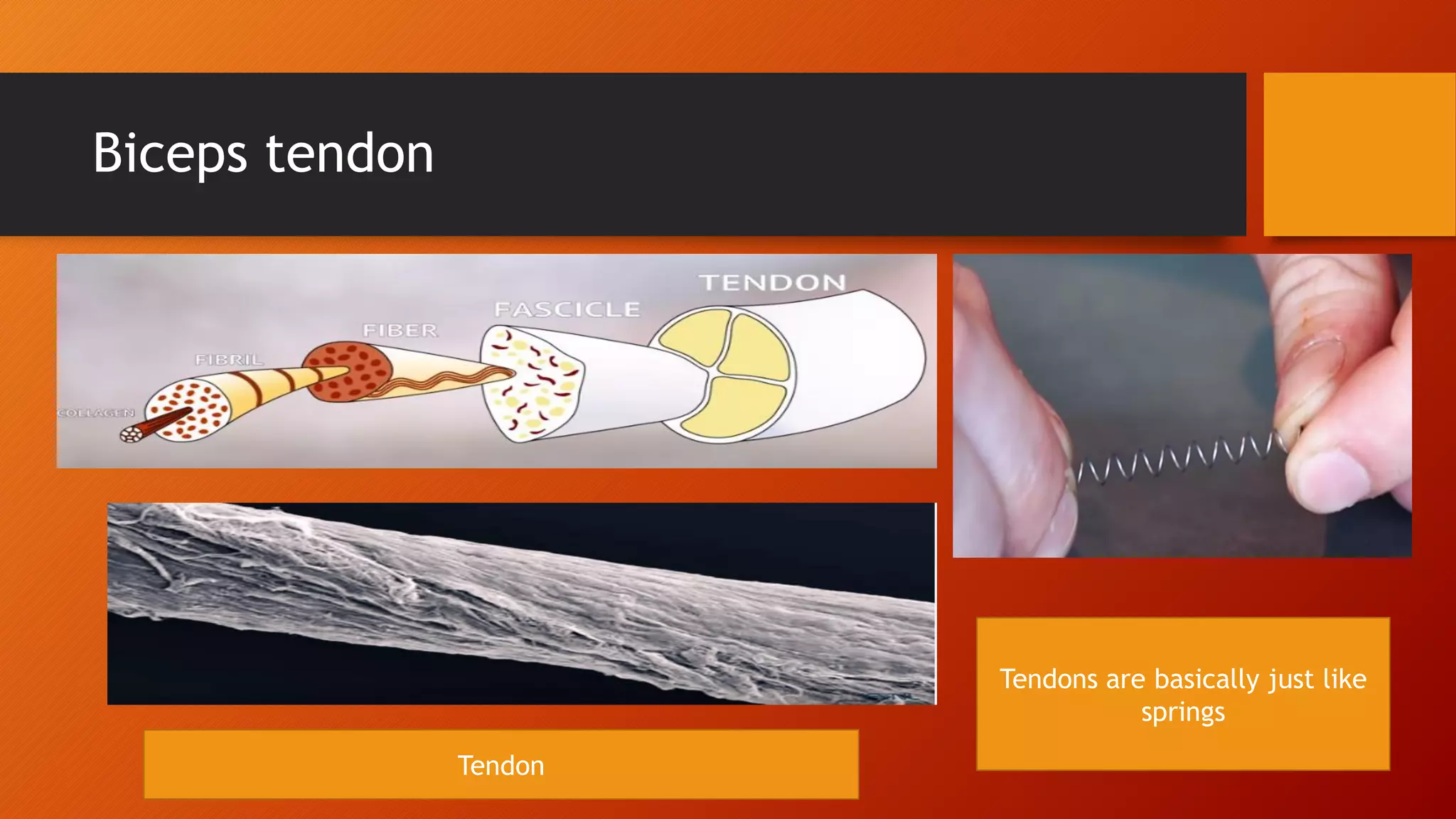 Bicep Femoris Tendinitis | PDF