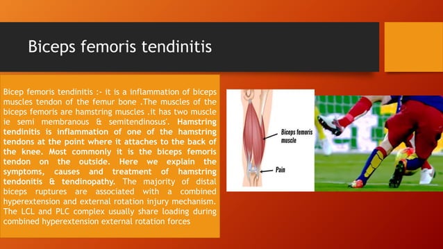 Bicep Femoris Tendinitis | PDF | Death, Injury, or Military Conflict ...