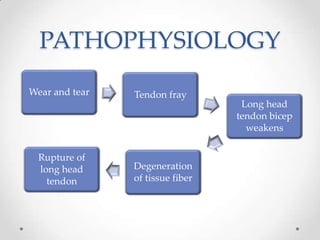 Biceps Tendon Rupture And Physiotherapy Management | PPTX