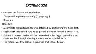Biceps Rupture | PPTX