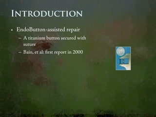 Biceps Tendon Repair - Endobutton | KEY