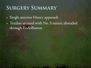 Biceps Tendon Repair - Endobutton | KEY
